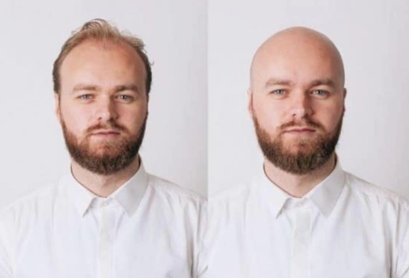 See What Would You Look Like Bald with 4 AI Bald Filters